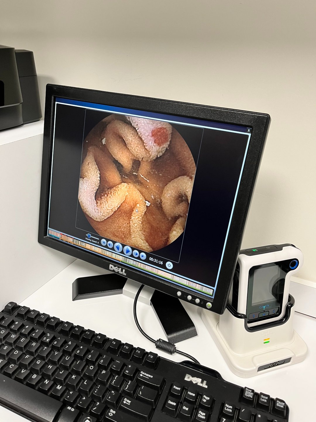 WHAT IS ENDOSCOPY AND ENDOSONOGRAPHY - PROCEDURES - DR. SUAT OZDEN ...